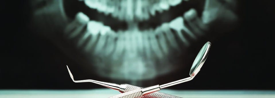 SNAP Digital Imaging Newcastle: Charlestown Dental Centre